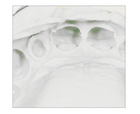 Kromatica Color Changing Alginate Impression Material – GINGI-PAK